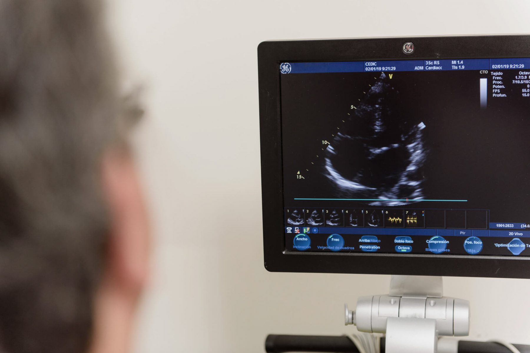 ecografia-1 - Cedic Diagnóstico